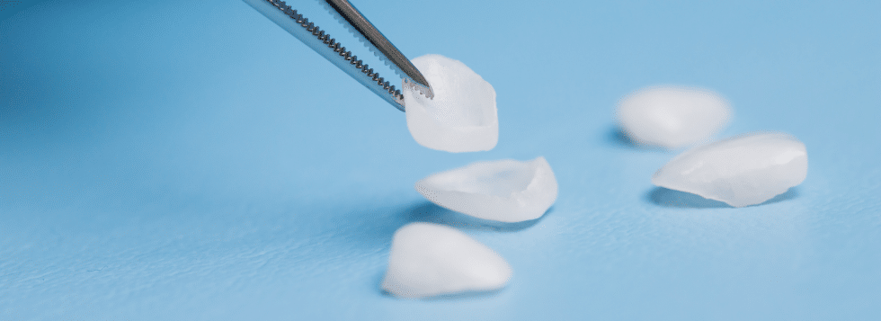 Porcelain Veneers vs Composite Veneers | CosMediSmile Blog Porcelain Veneers vs Composite Veneers | CosMediSmile Blog